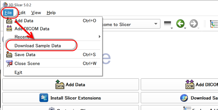 3D Slicer Sample dataの読み込み方 - 小倉の自由研究